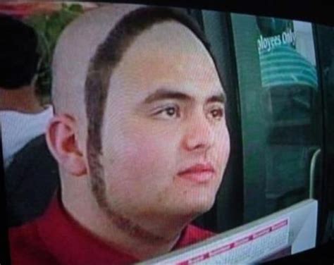 Bad Worst Hairlines