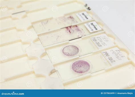 Microscope Slide Substitute At Misty Mcdonald Blog