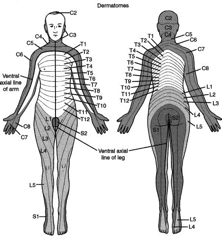 Spinal Stenosis History And Physical Examination Physical Medicine