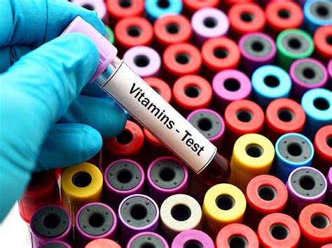 Folate Deficiency Causes Symptoms And Diagnosis