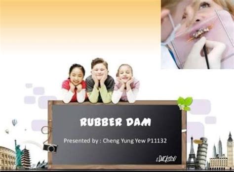 Ashish Vaish On Linkedin Are You Safe During Treatment Time Yes We Use Rubberdam