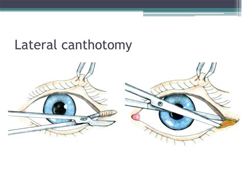 Ophthalmic Emergencies Ppt Video Online Download