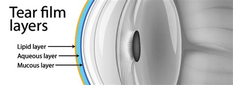 What Is Dry Eye Price Vision Group