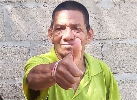 Cuerpo Hallado En La Vía Sabanalarga Manatí Sería De Hombre Reportado