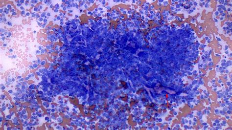 Musculoskeletal Eclinpath