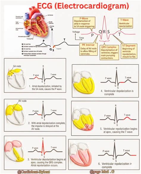 Ecg Interpretation Characteristics Of The Normal Ecg P Wave Qrs Complex