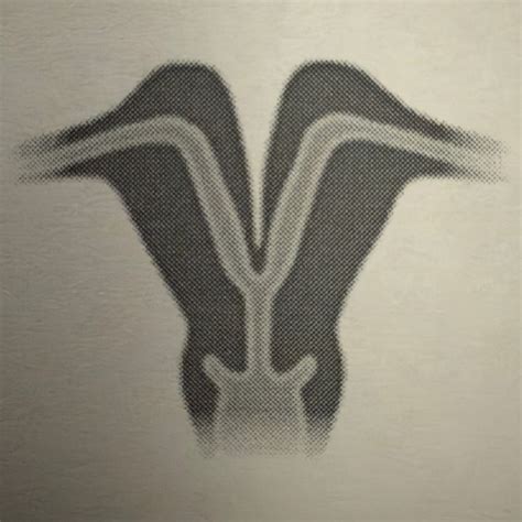 Ch 43 Pathology Of The Uterus Flashcards Quizlet