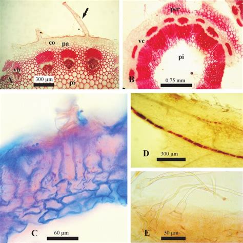 Stem And Leaf A Transection Of A Stem With Primary Growth The Arrow