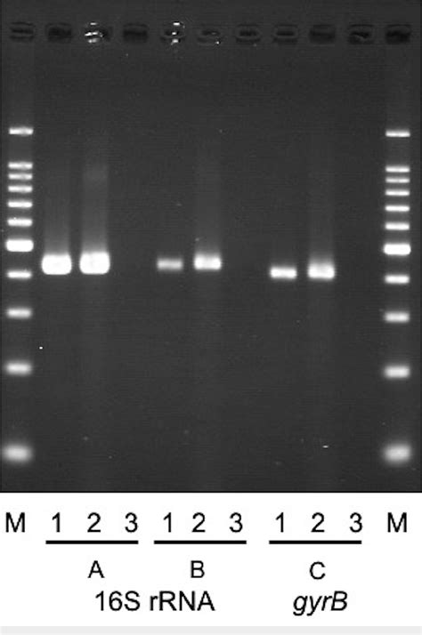 Figure 2 From A Case Of Uncomplicated Bacteremia Caused By Capnocytophaga Canimorsus In An