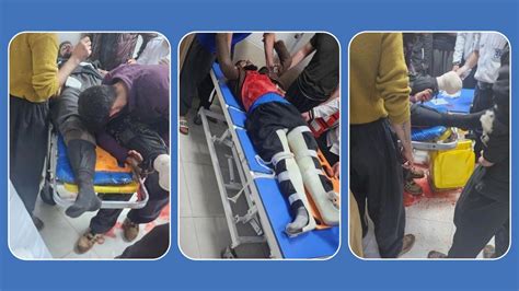 نوسود؛ یک کولبر بر اثر انفجار مین از ناحیه پا دچار نقص عضو شد