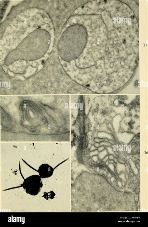 Electron Microscopic Structure Of Protozoa 1963 Electron Microscopic