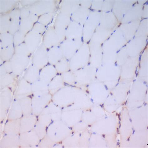 In The Micrograph Of The Control Group Brown Staining Is Observed In A