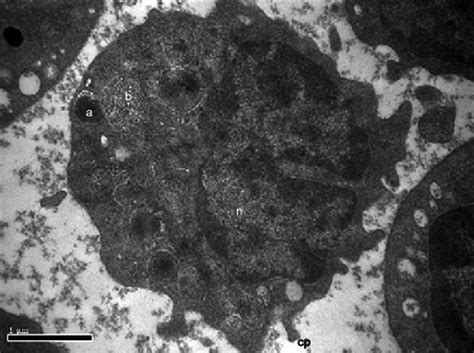 Transmission Electron Photomicrograph Of Basophil Showing Download
