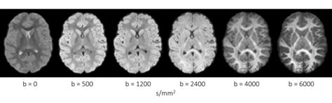 Spherical Harmonics Zero Order Maps Derived From A Representative