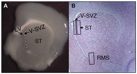 Subventricular Zone Mouse Brain