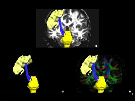 Introduction To Diffusion Mri Processing The Diffusion Process
