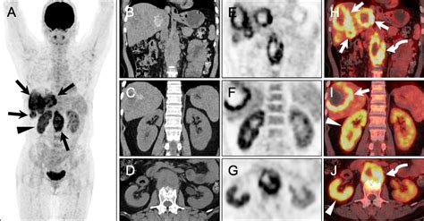 Clinical Nuclear Medicine