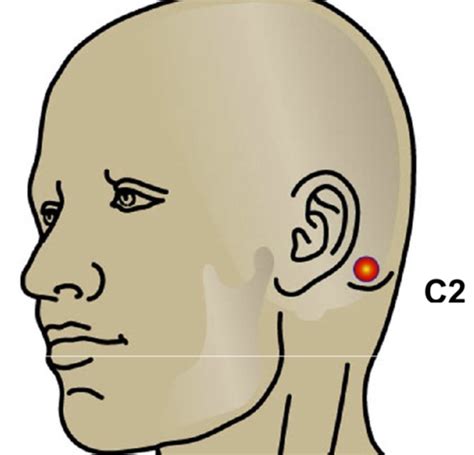 Dermatome Testing And Monofilament Test Flashcards Quizlet