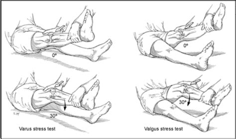 Knee Special Tests And Mobs Flashcards Quizlet