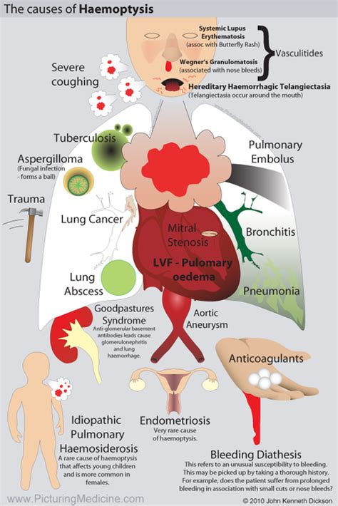 Picturing Medicine Differential Diagnoses The Causes Of