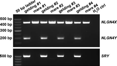 Representative Agarose Gel Electrophoresis Of Pcr Amplification