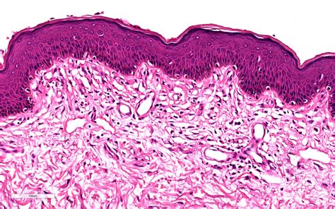 Pathology Outlines Anatomy And Histology Penis