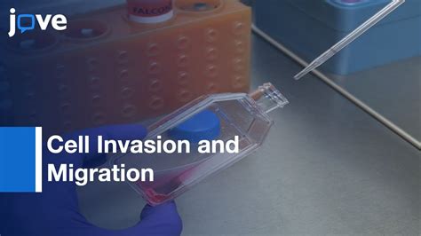 Boyden Chamber Assay Protocol At Jennifer Felder Blog