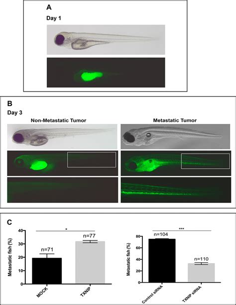 Regulatory Effects Of Txnip On Metastatic Ability Of Hcc Cells In Download Scientific Diagram