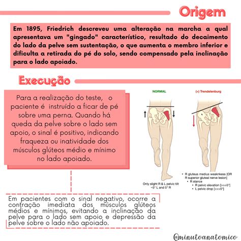 Minuto Anatomoclínico 15 Marcha De Trendelenburg Anatomia