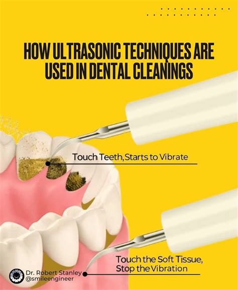 Robert J Stanley Dds Phd Ms On Linkedin Dentalcleanings