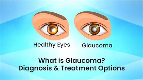 What Is Glaucoma Diagnosis And Treatment Options