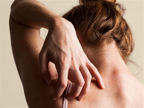 Mild Eczema On Back Red Spots On Skin Pictures Causes Treatment