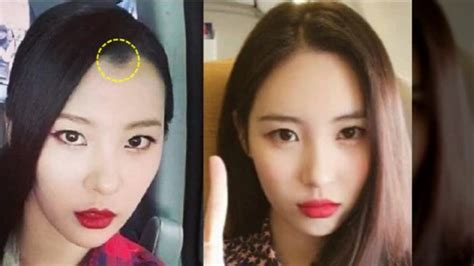 좁은이마제모 연예인이마라인 어떤 비밀이 네이버 블로그