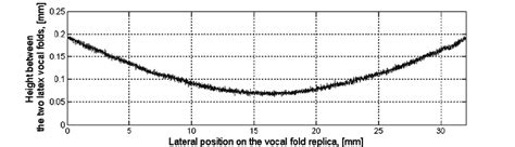 Frontal View Of The Deformable Vocal Fold Replica Realised Displacing Download Scientific