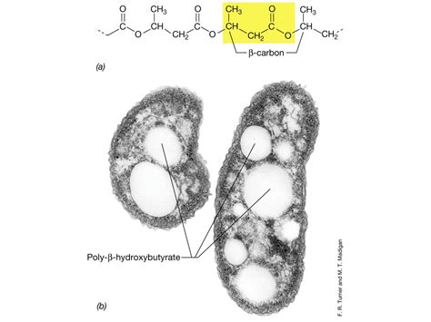 Solution Microbiology And Parasitology Bacteria Ultrastructure 3