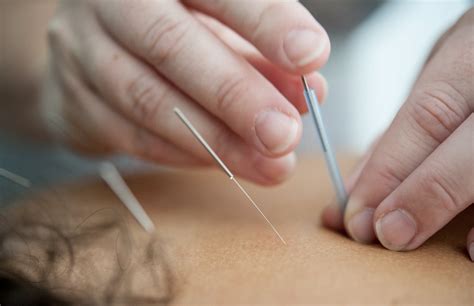 How Deep Do Acupuncture Needles Go An In Depth Look 2024 — Holistic