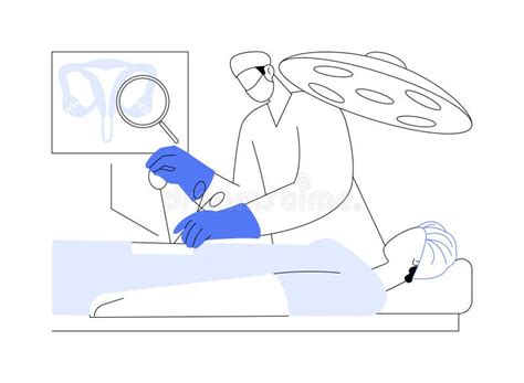 Pelvic Laparoscopy Stock Illustrations 11 Pelvic Laparoscopy Stock Illustrations Vectors