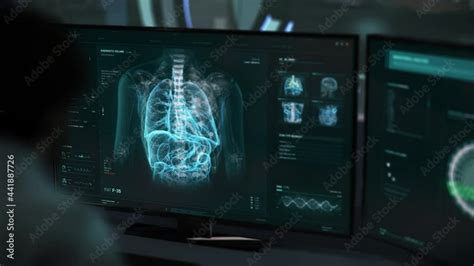 Vidéo Stock Medical Bio Analysis A Doctor Is Supervising The Bio Analysis Process The Lungs Of