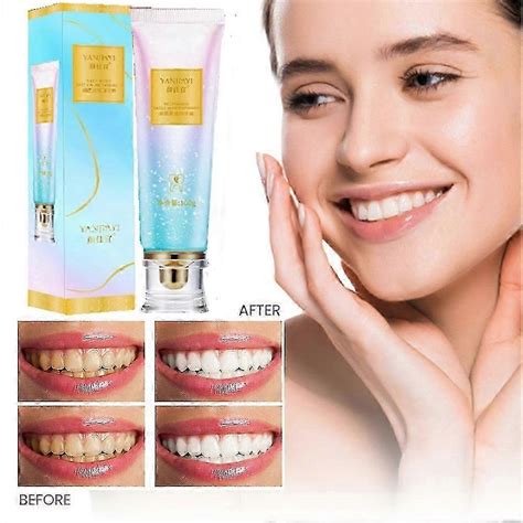 200g Nicotinamide Bright White Anti Sensitive Toothpaste Whitening