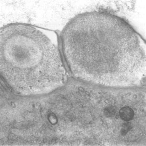 Transmission Electron Micrograph Showing Cryptosporidium Adhering To