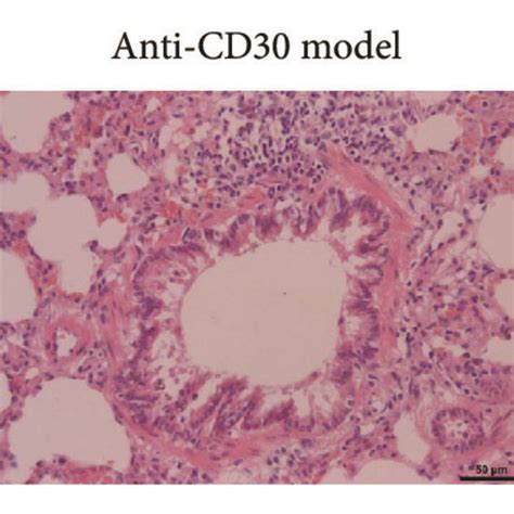 Lung Tissue Structure Characteristics In Rat Models Representative