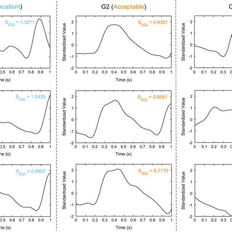 Pdf An Optimal Filter For Short Photoplethysmogram Signals