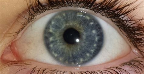 The Dots Of My Iris R Mildlyinteresting