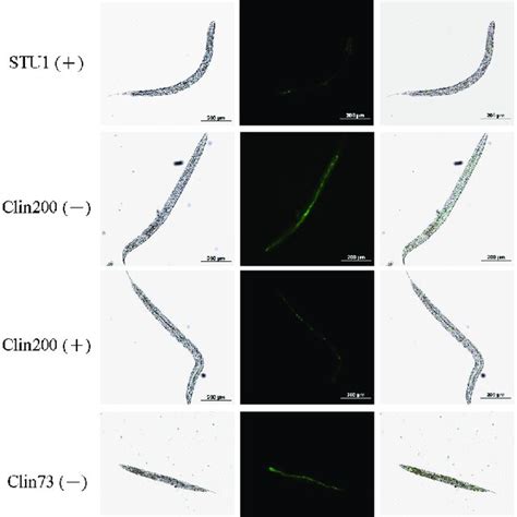 Quantification Of Bacteria In The Gut Of C Elegans The Bacteria