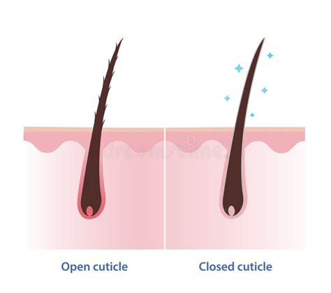 Scalp Layer Stock Illustrations 1144 Scalp Layer Stock Illustrations Scalp Layer Stock Illustrations 1144 Scalp Layer Stock Illustrations