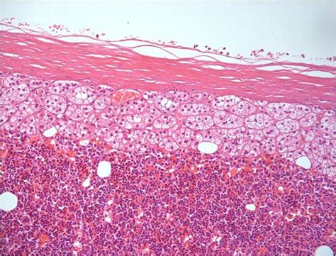 Same Histologic Features In Higher Fields Download Scientific Diagram