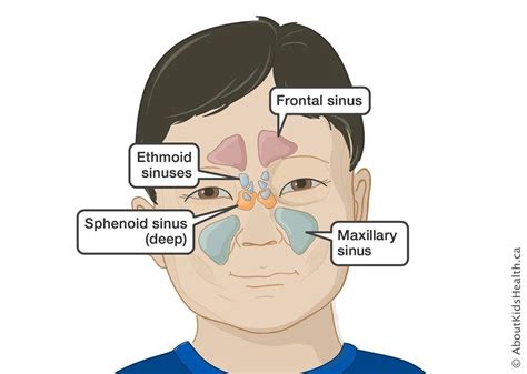 Sinusitis Private Gp And Wellness Clinic Belfast
