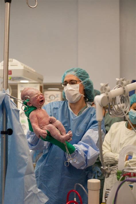 Pregnancy Delivery Operation