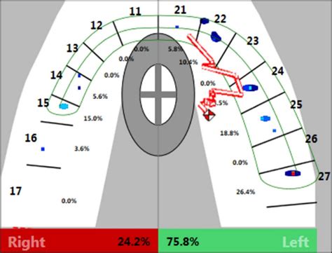 Force Distribution On Occlusal Splints Using T Scan Occlusal Analysis Published In Advanced