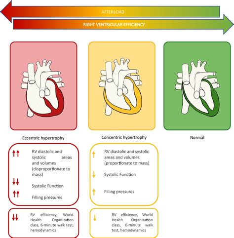 Right Ventricular Dysfunction Guidelines At Jack Black Blog